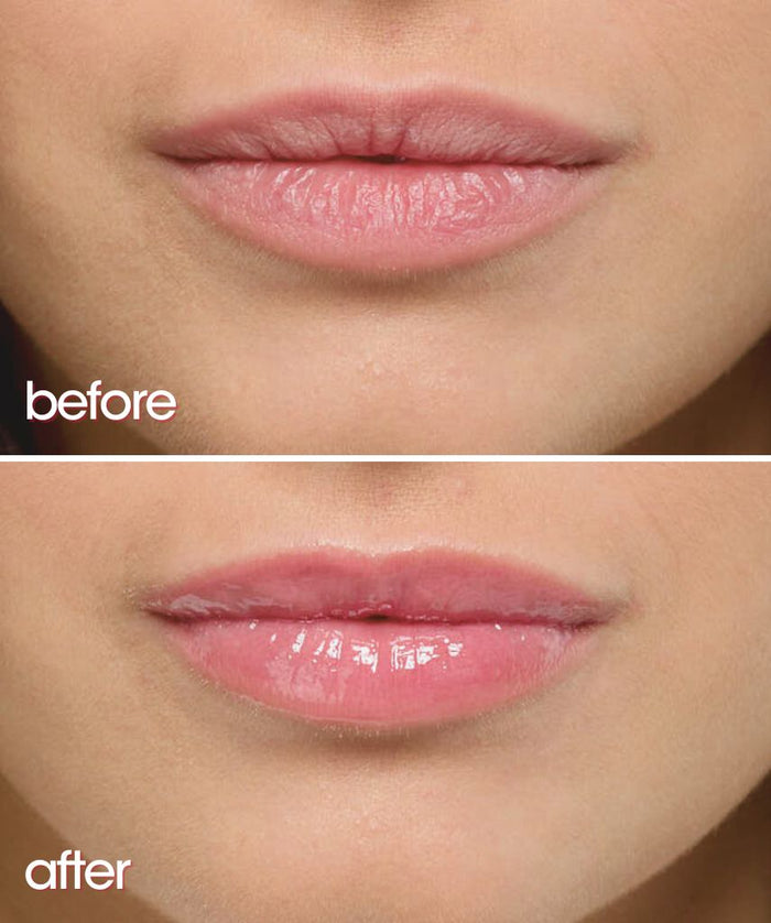 Anti-Aging Lip Treatment For Lip Lines | Lipaddict #208 Razzle Dazzle